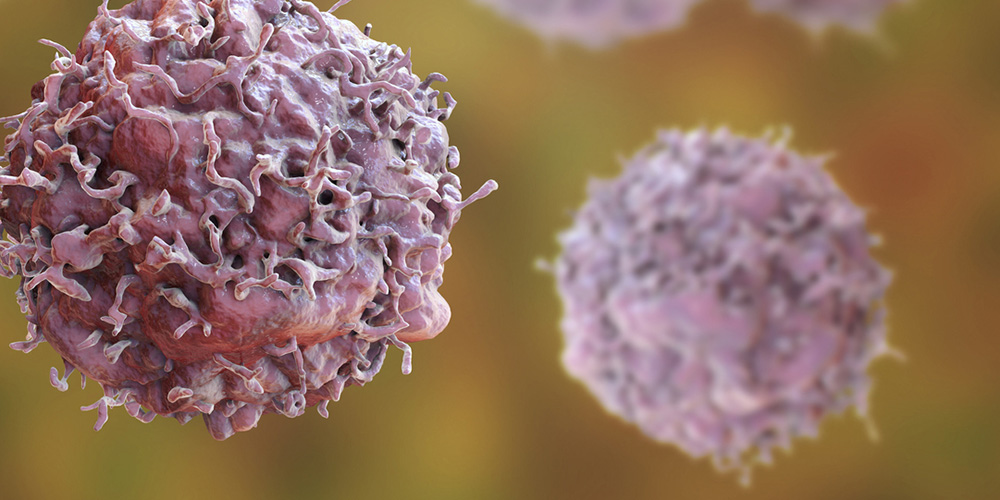 New CAR T-cell Target for Gastrointestinal Cancers | Alliance for ...