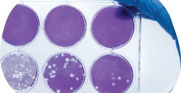 Unique cell therapy in testing for ovarian cancer | Alliance for Cancer ...